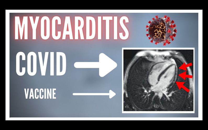 Myocarditis, COVID and Covid Vaccines (Pfizer and Moderna Vaccines)
